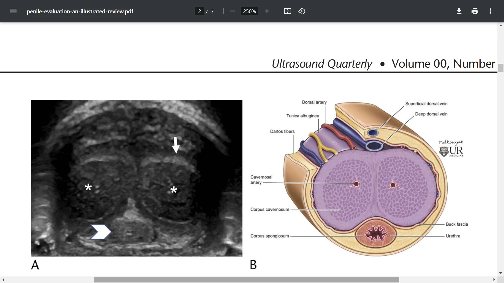 High-frequency ultrasound for penile evaluation in ED diagnosis | Excel Male TRT Forum