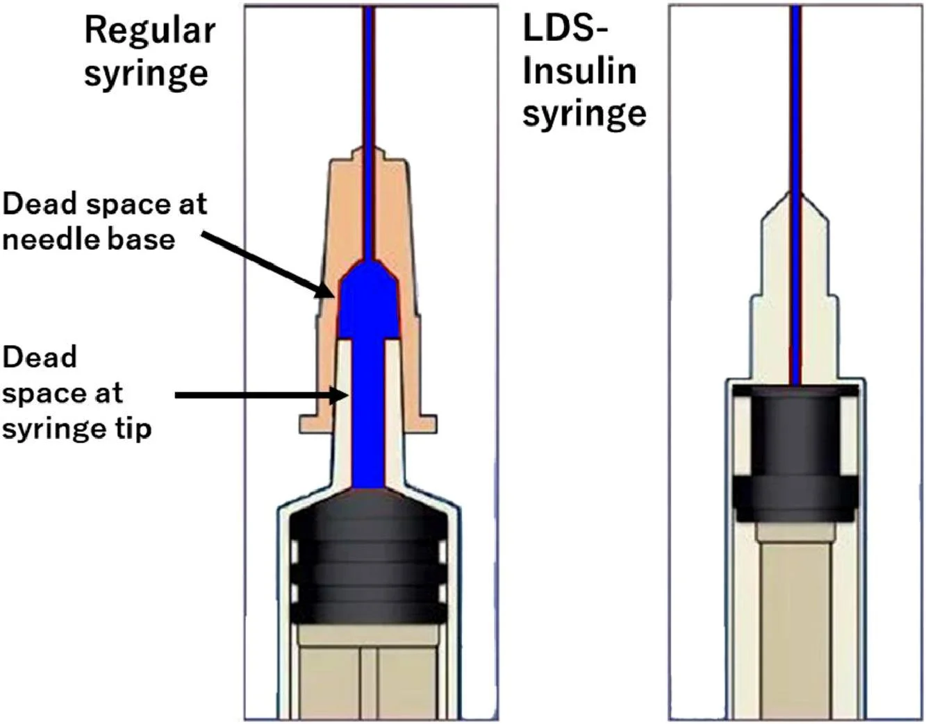 How to Inject Testosterone Intramuscularly, Shallow IM or ...