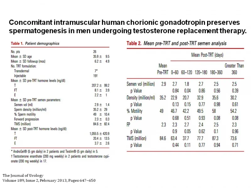 Hcg Plus Trt To Prevent Reverse Testicular Shrinkage And Decreased