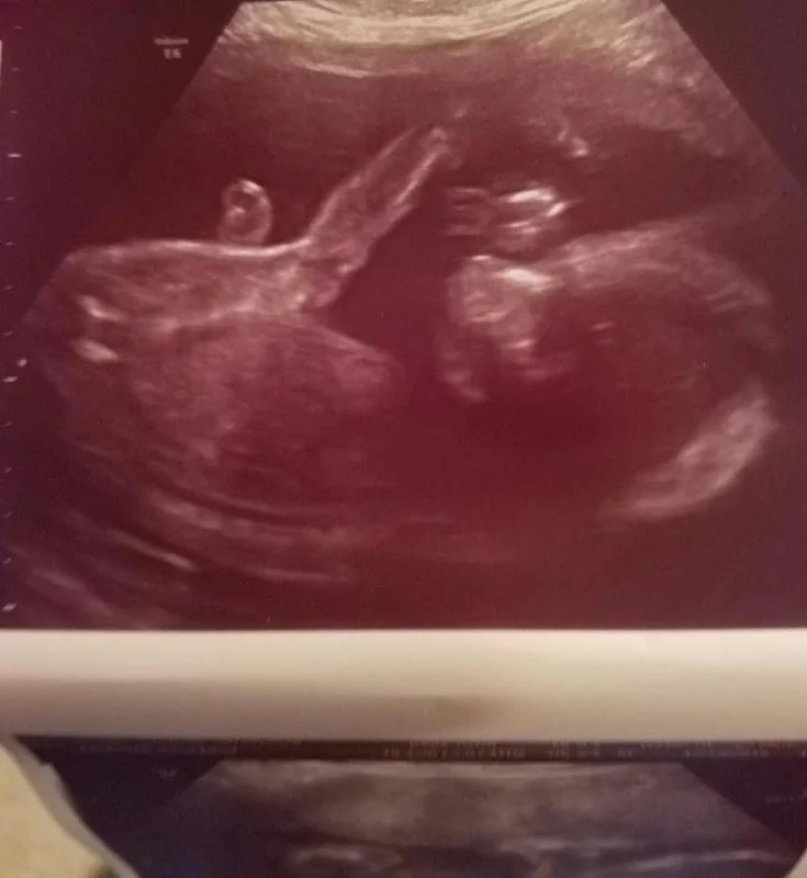 Topical DHT for penile growth? | Excel Male TRT Forum