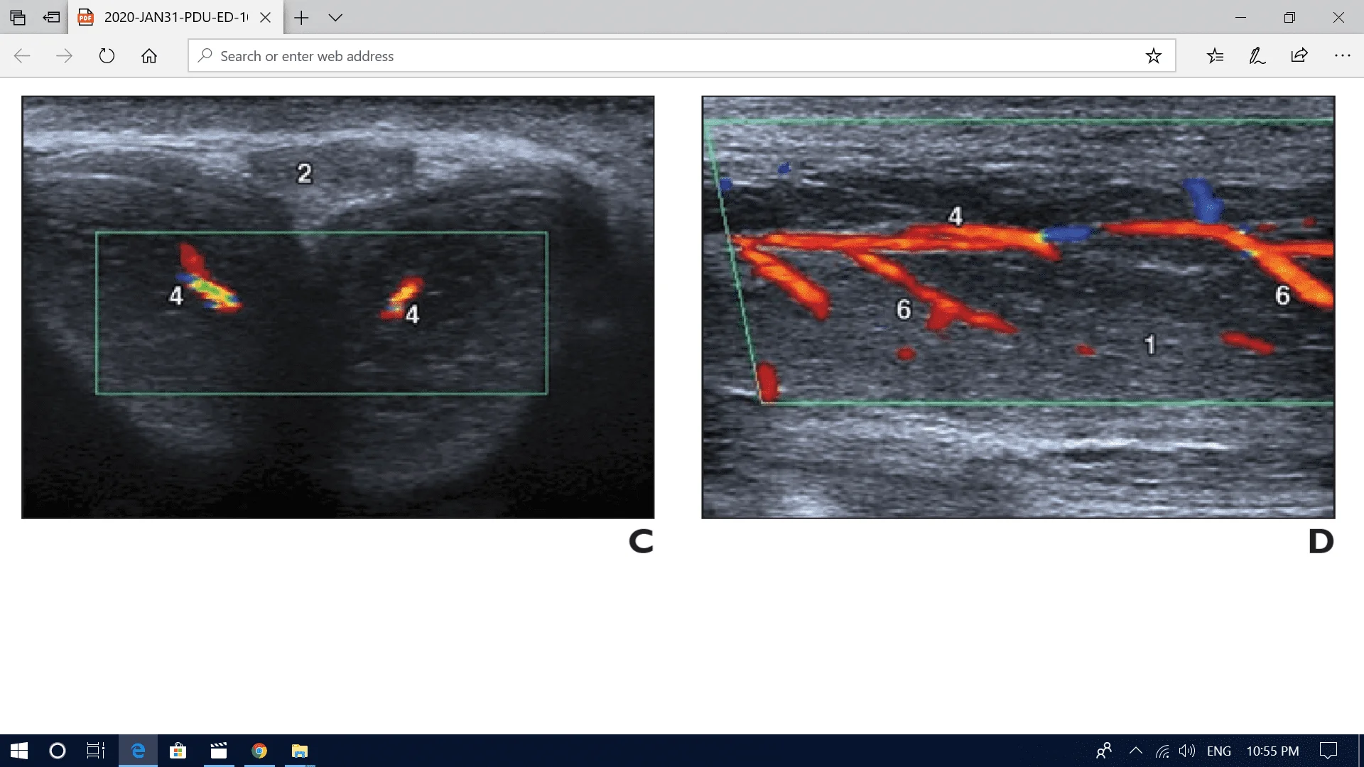 Penile Doppler Ultrasound for Erectile Dysfunction: | Excel Male TRT Forum