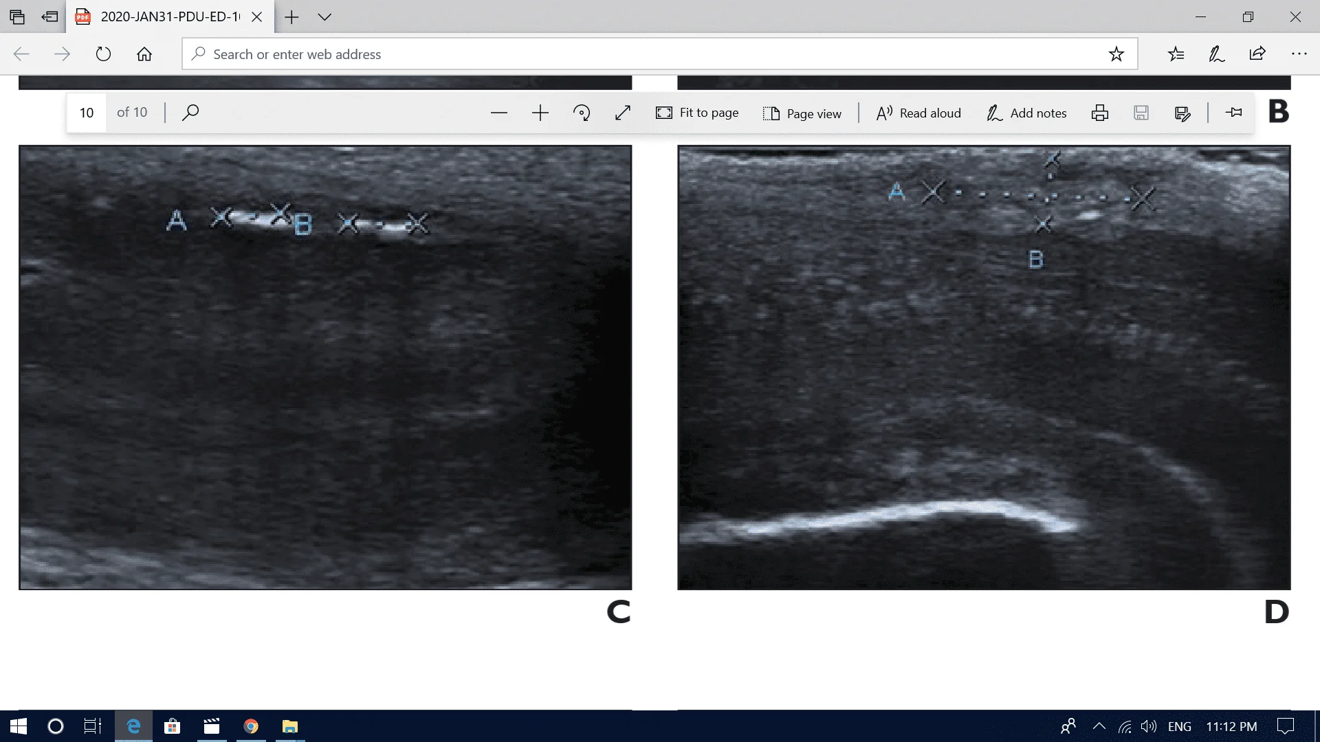 Penile Doppler Ultrasound for Erectile Dysfunction: | Excel Male TRT Forum