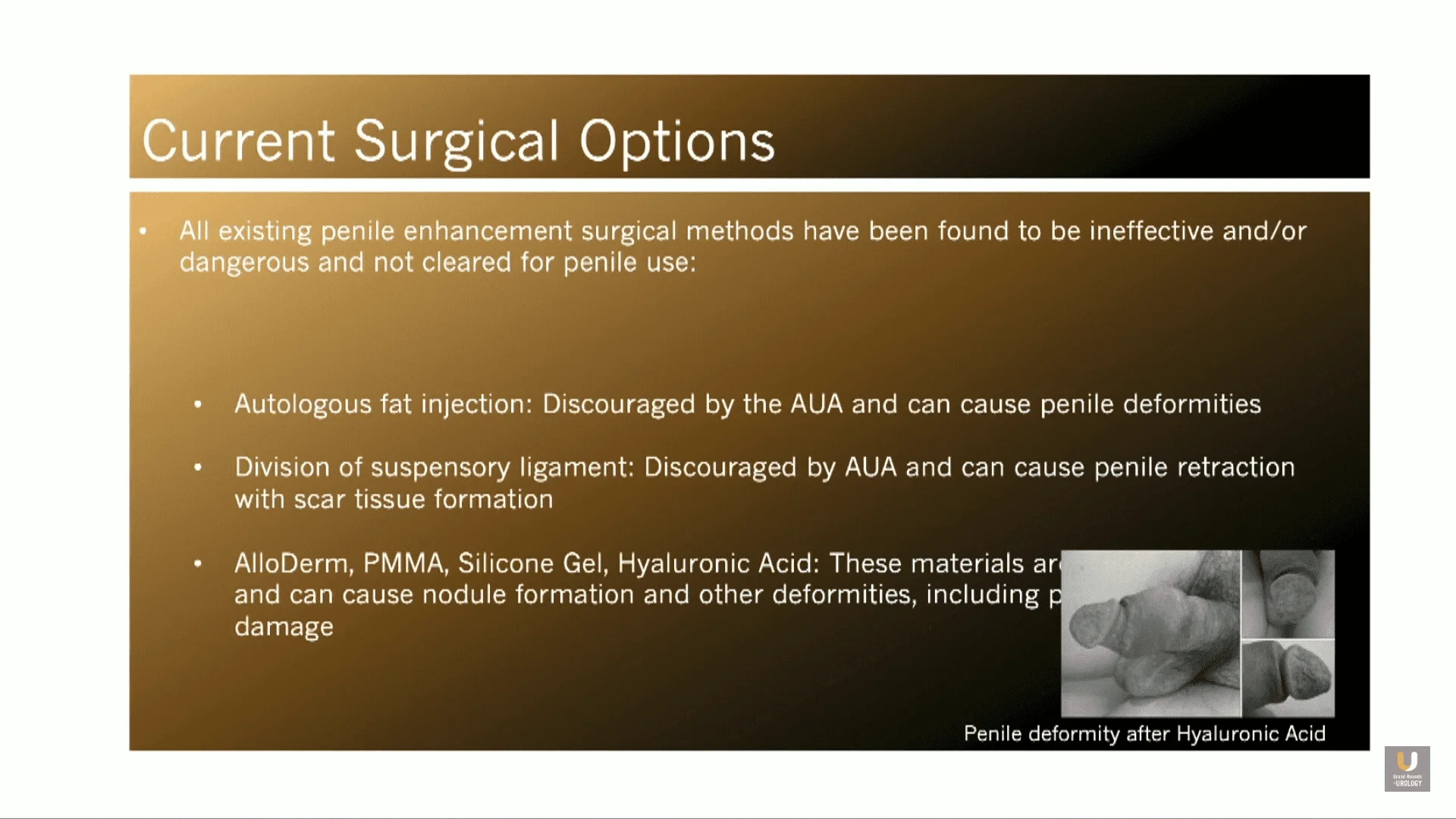 The History of Penile Enlargement and the Advent of Penuma | Excel Male ...