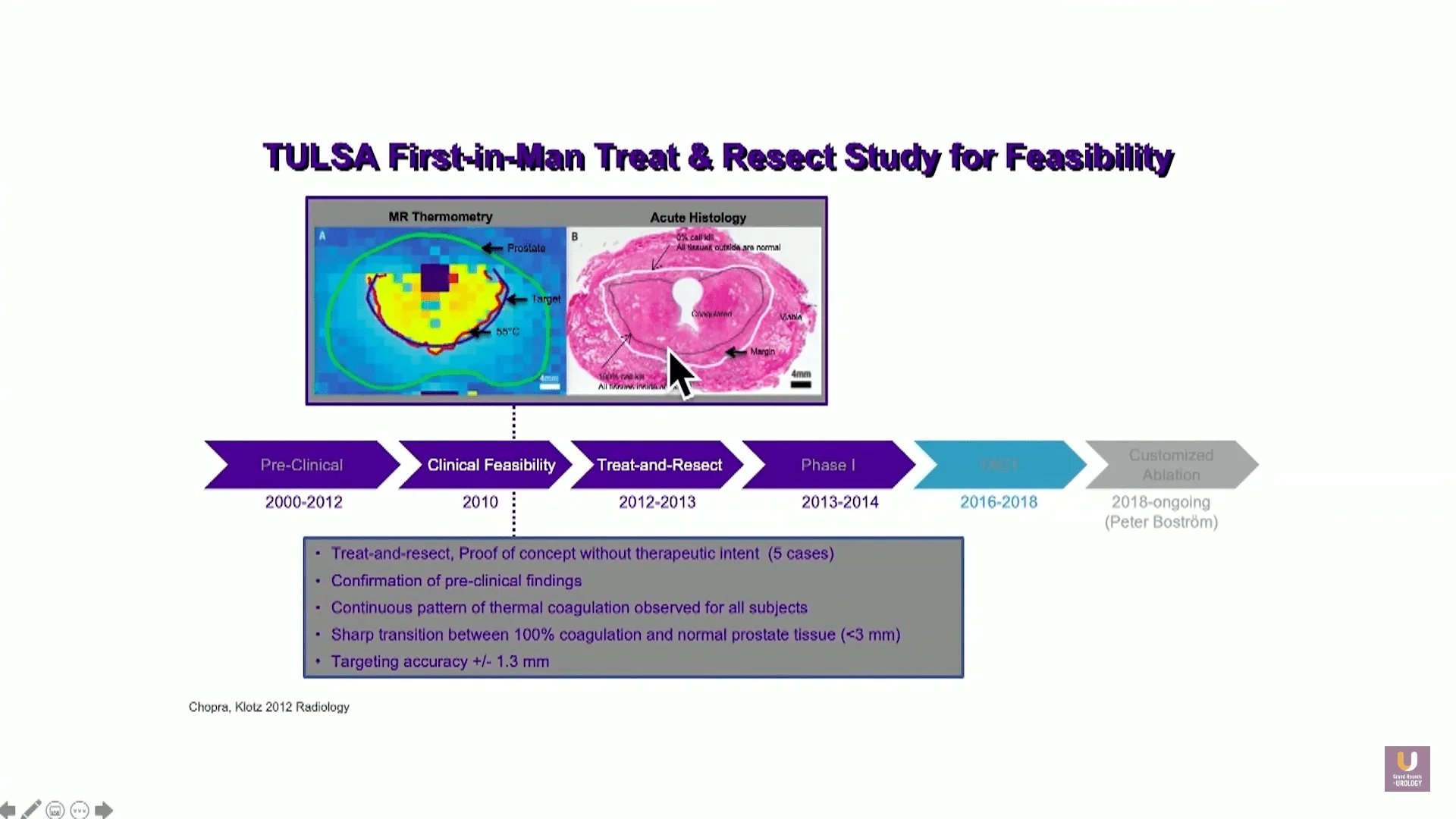 MRI-guided Transurethral Ultrasound Ablation (TULSA) for Prostate ...