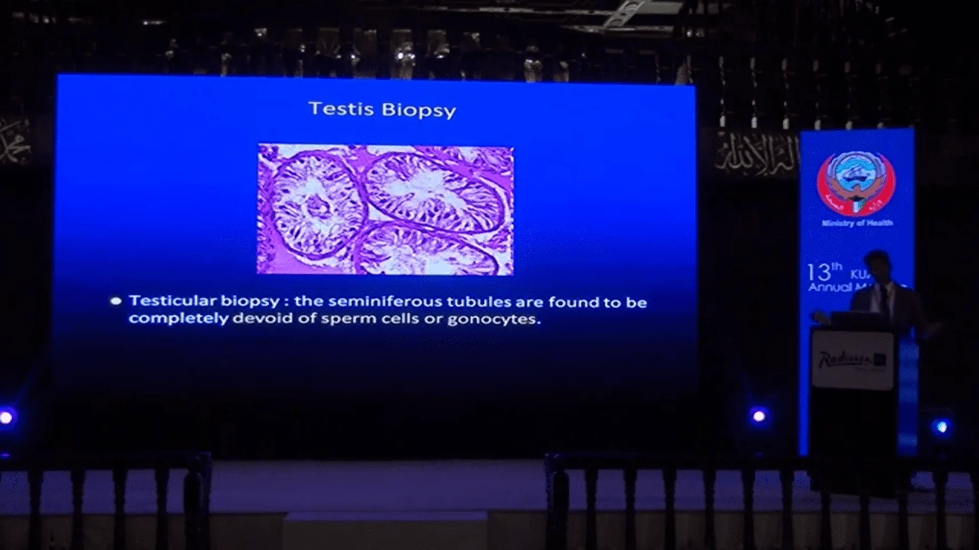 Microscopic testicular sperm extraction (Micro-TESE) | Excel Male TRT Forum