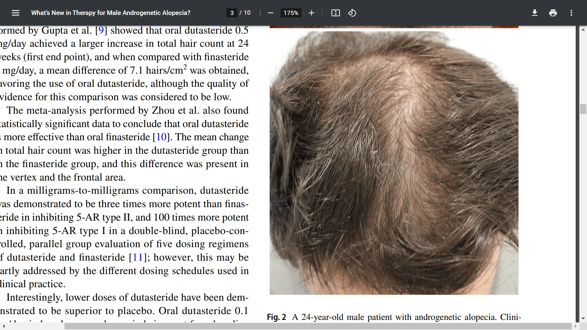 New Therapies for Male Androgenetic Alopecia? | Excel Male TRT Forum