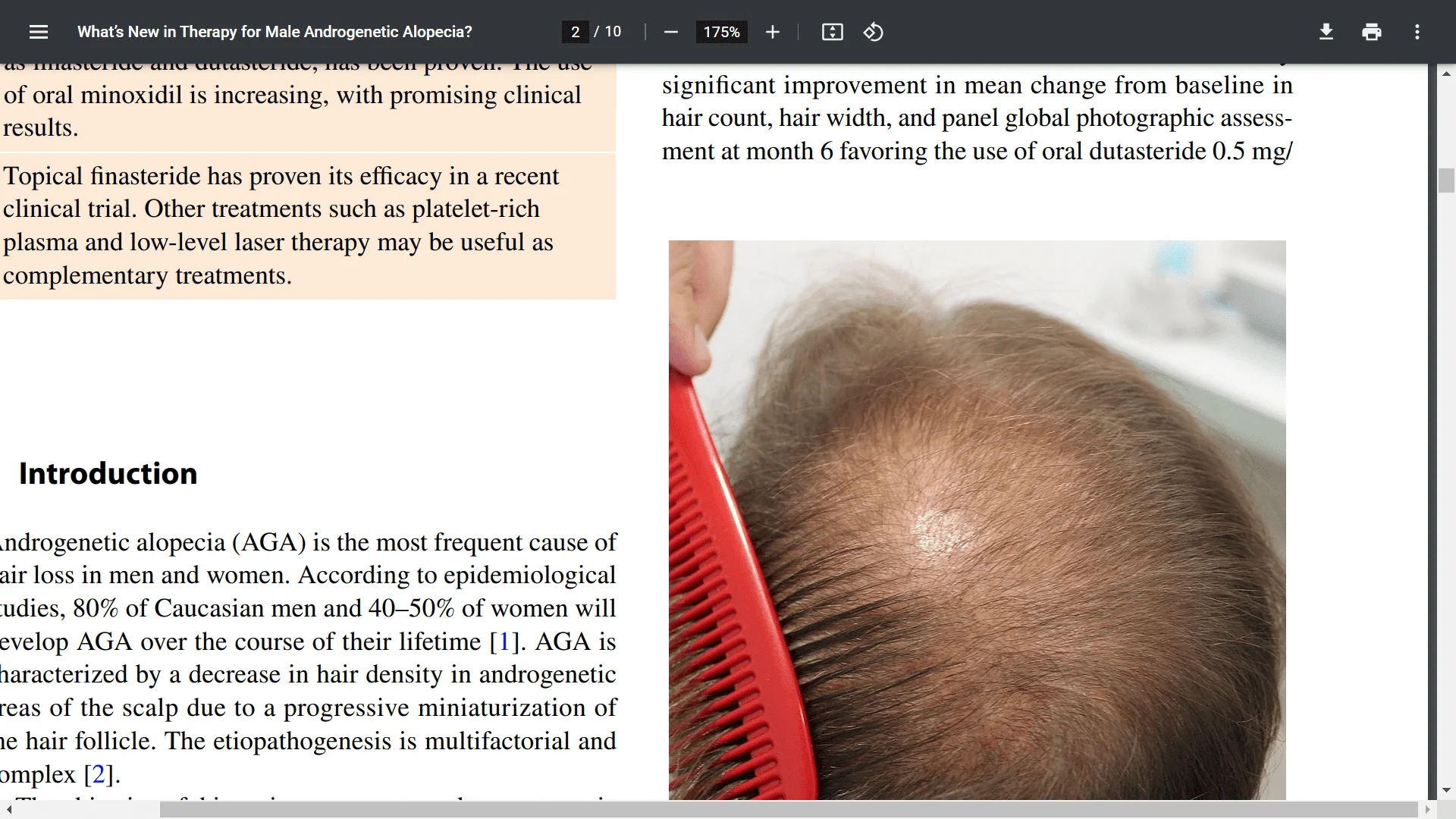 New Therapies for Male Androgenetic Alopecia? | Excel Male TRT Forum