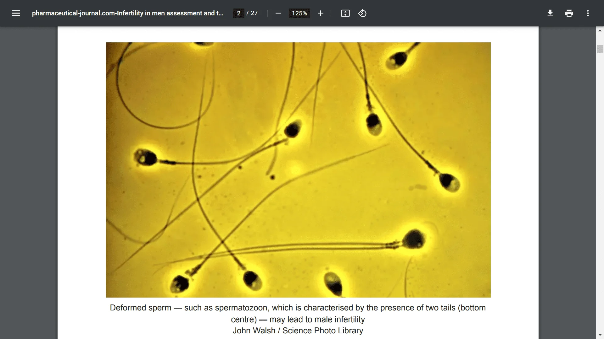 Infertility in men: assessment and treatment | Excel Male TRT Forum