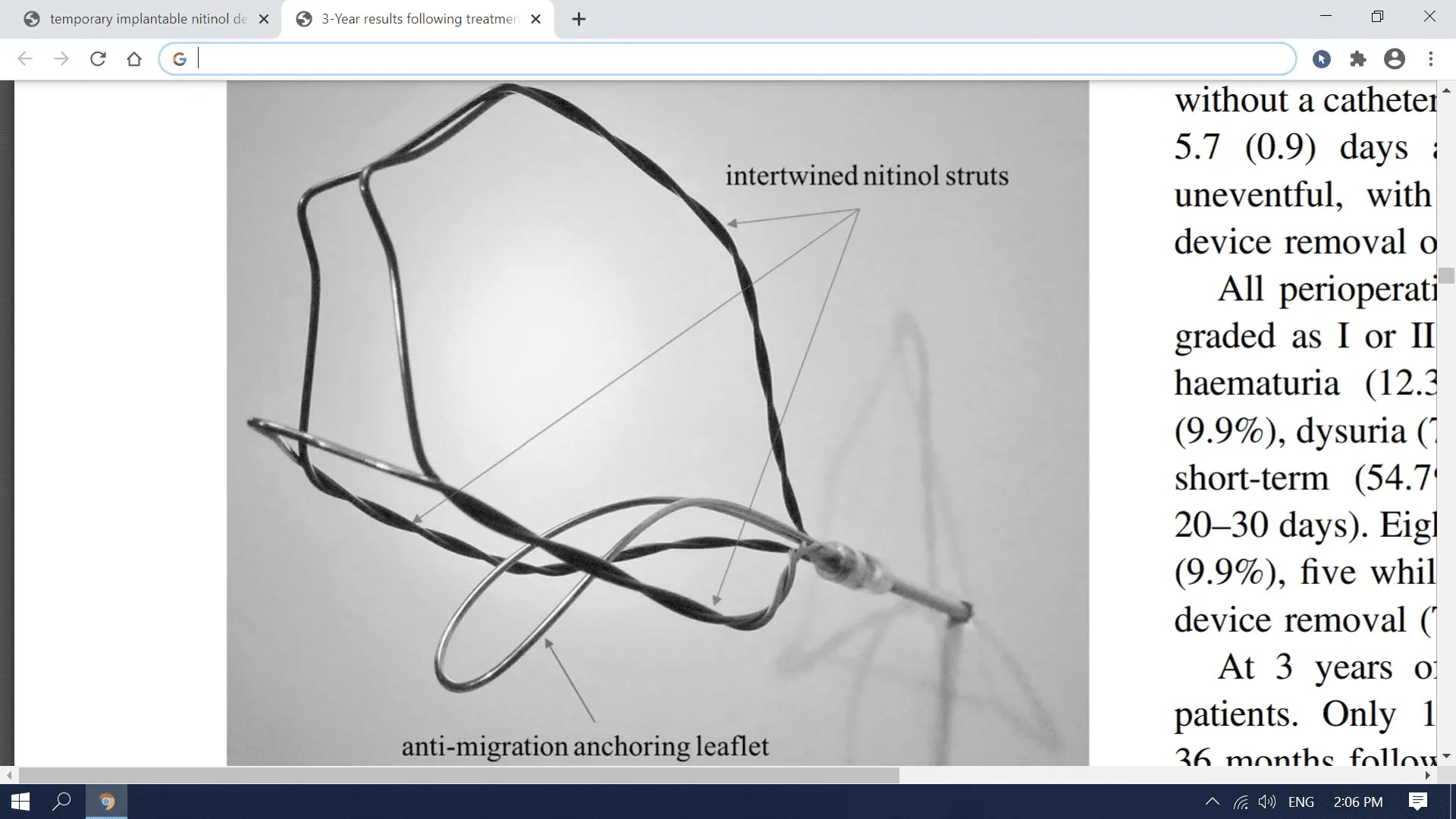 temporary implantable nitinol device in men with LUTS secondary to BPH ...