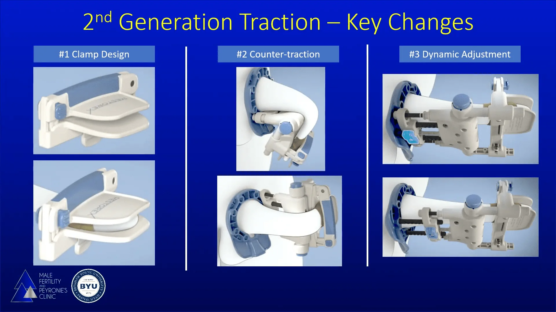 Development and advantages of the RestoreX Penile Traction Device ...
