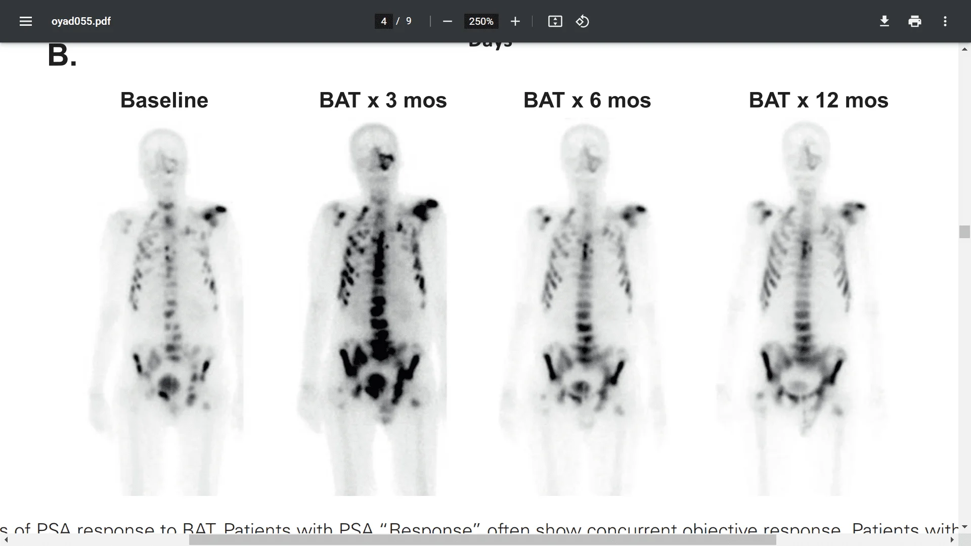 BAT Followed by AR Inhibition as Sequential Therapy for Prostate Cancer ...