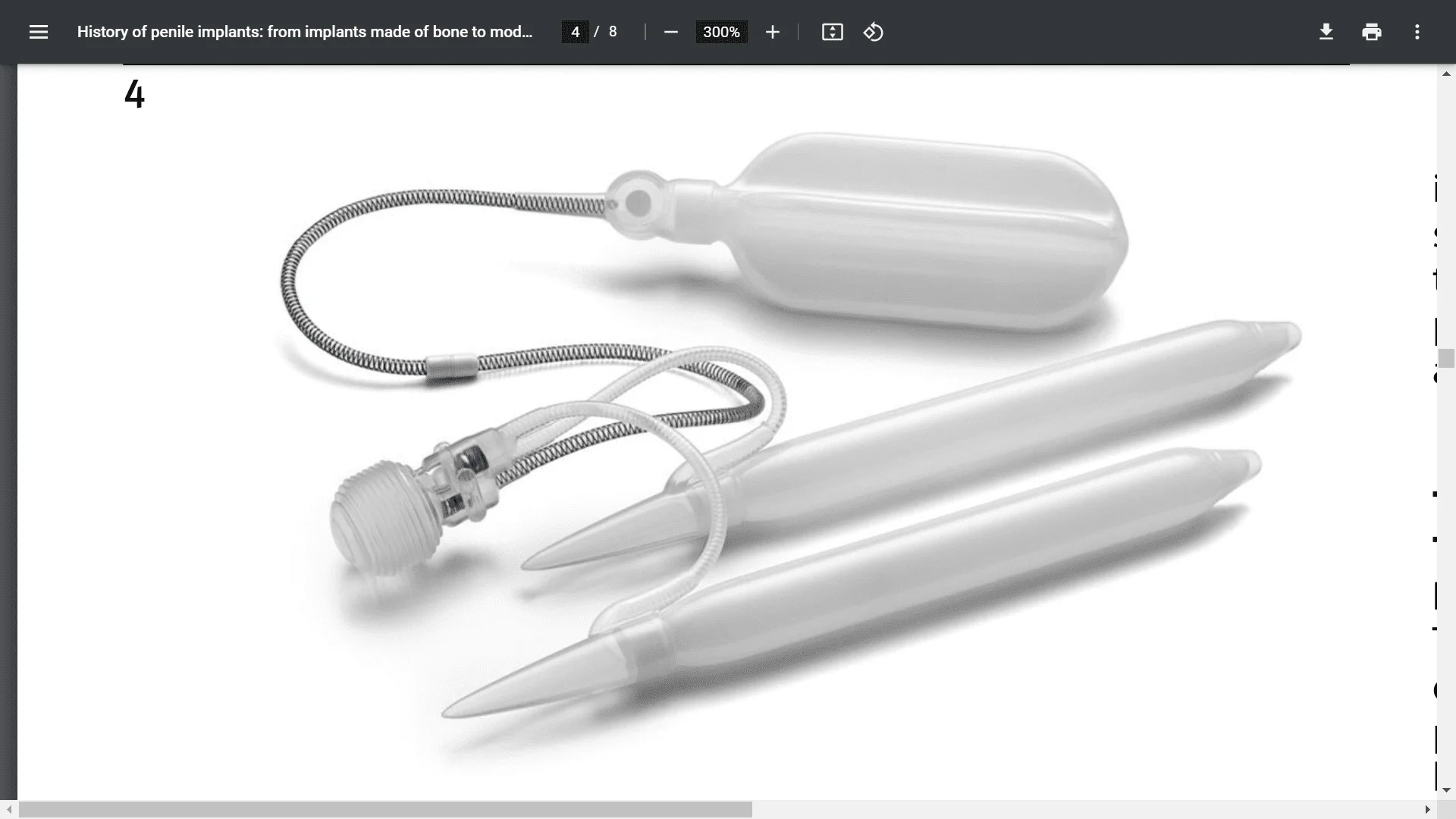 History of penile implants | Excel Male TRT Forum