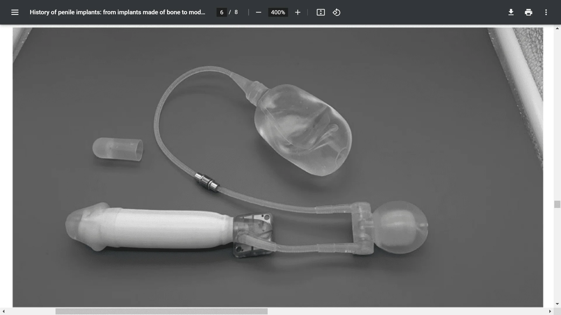 History of penile implants | Excel Male TRT Forum