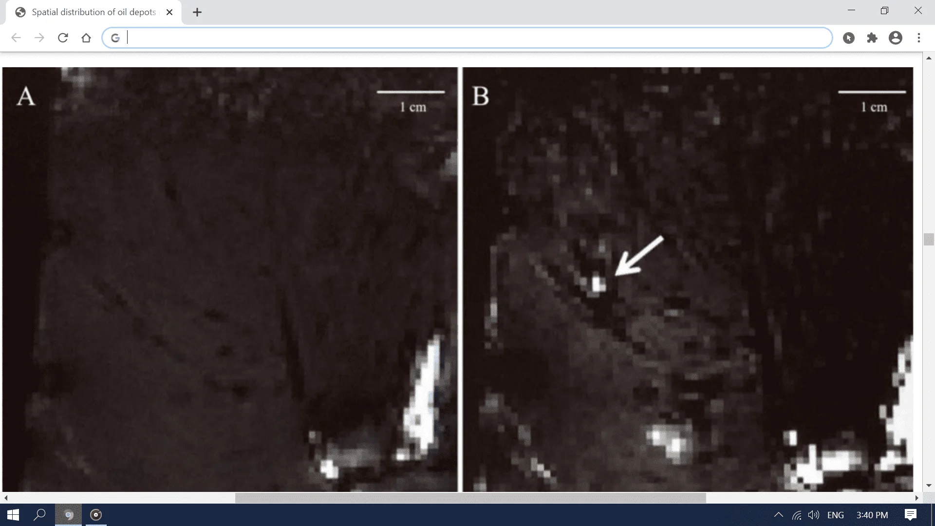 Spatial distribution of oil depots monitored in human muscle using MRI ...