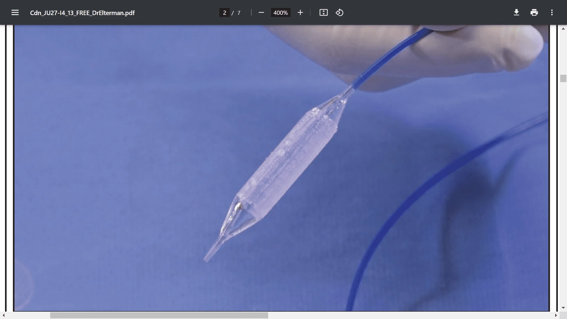 Optilume BPH catheter system | Excel Male TRT Forum