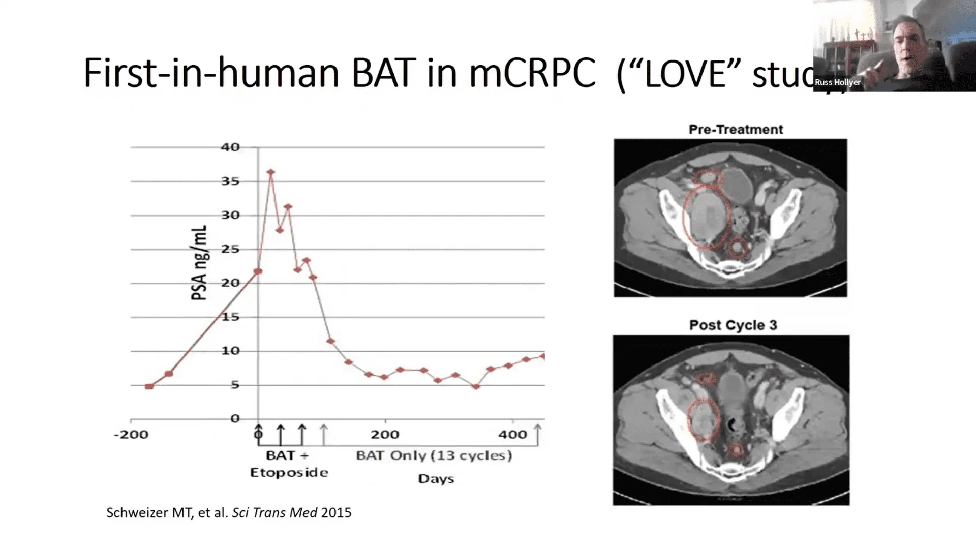 Prostate Cancer: Bipolar Androgen Therapy (BAT) | Excel Male TRT Forum