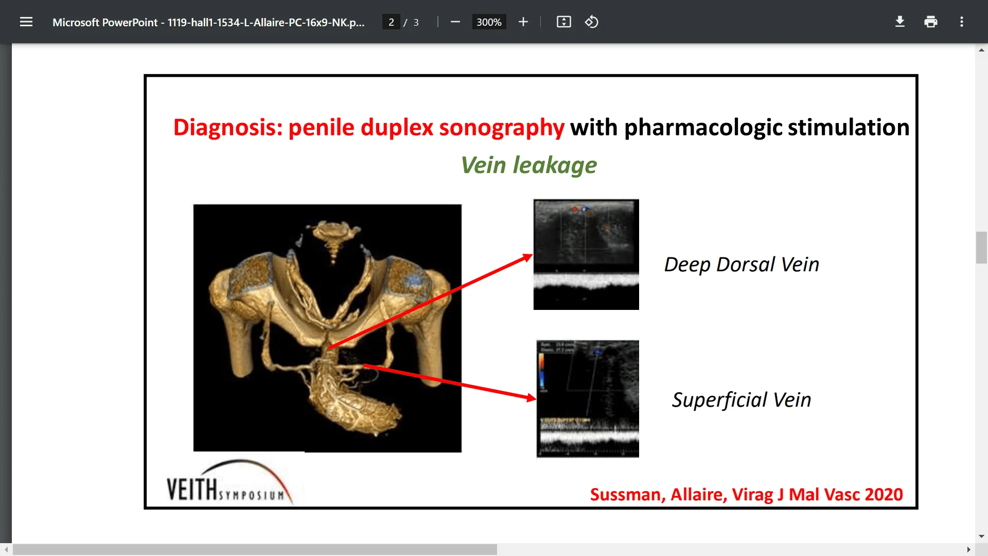 Progress In Open And Endovascular Treatment For Erectile Dysfunction ...
