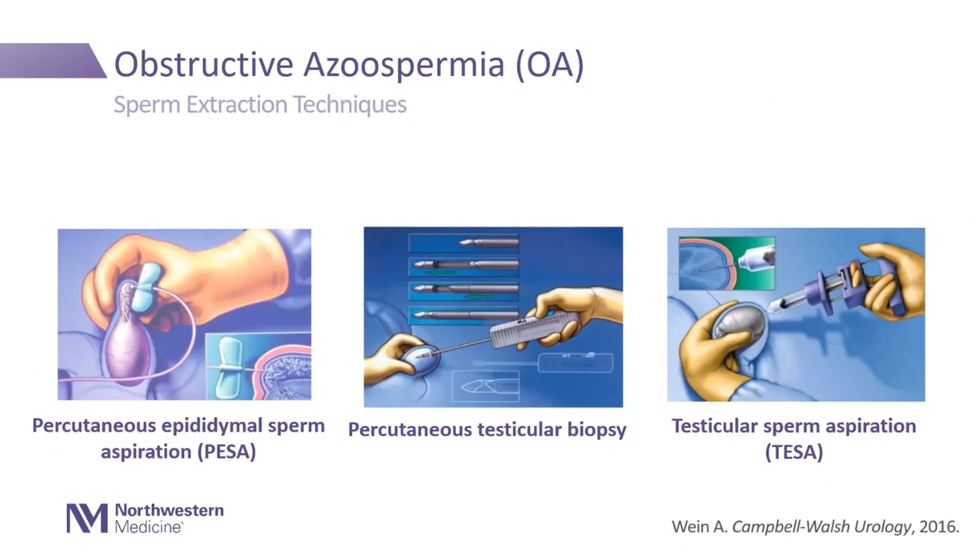 Male Infertility Guidelines - Diagnosis, treatment options, and ...