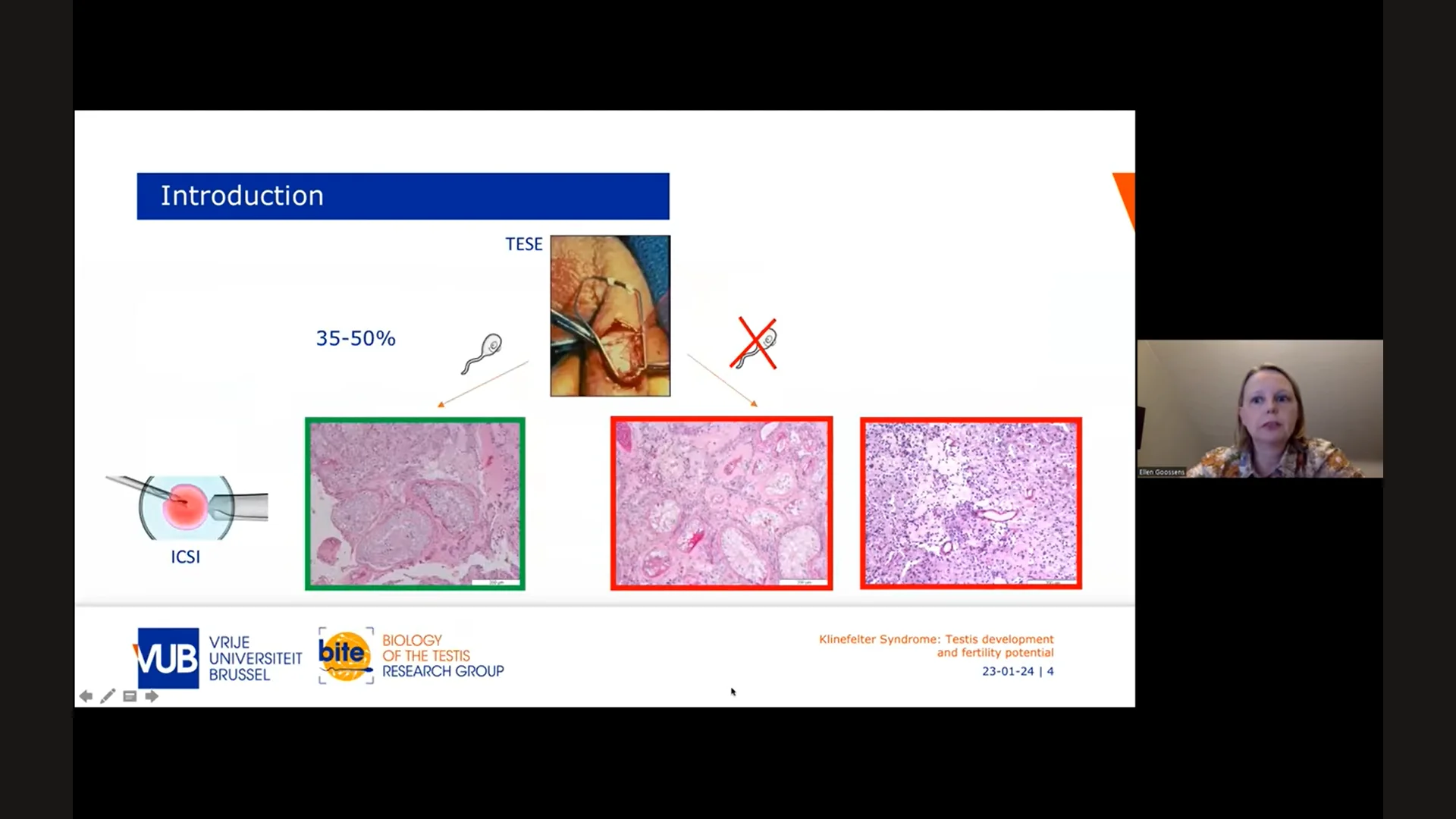 Klinefelter Syndrome - Testis development and fertility potential ...