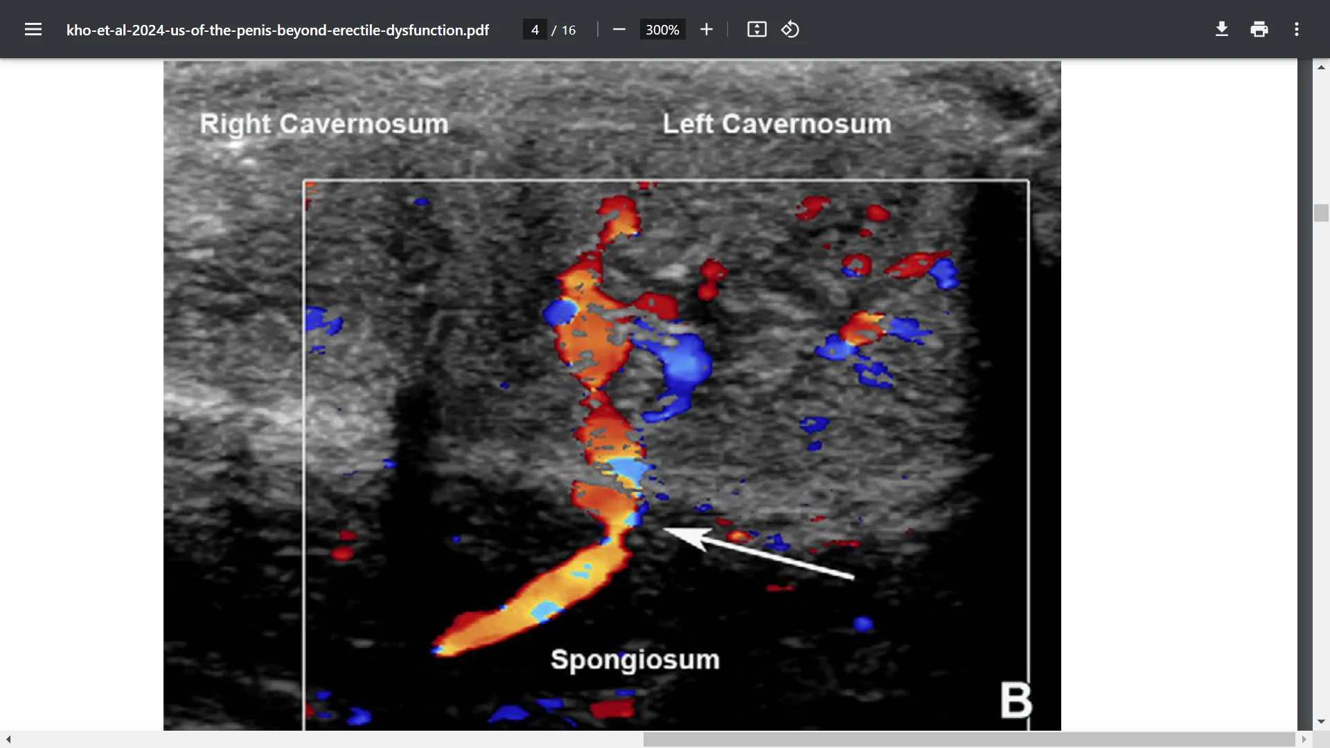 Penile Doppler US - Beyond ED | Excel Male TRT Forum