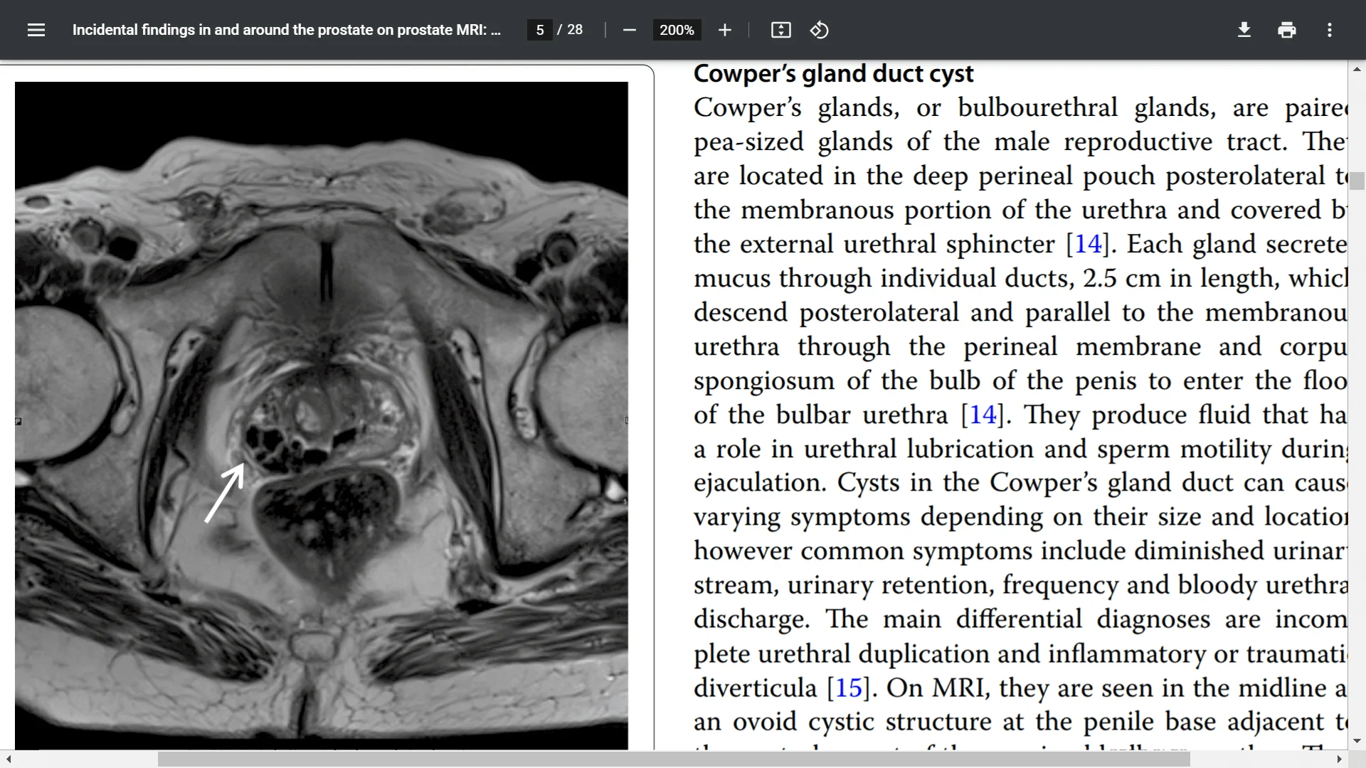 Incidental findings in and around the prostate on prostate MRI | Excel ...