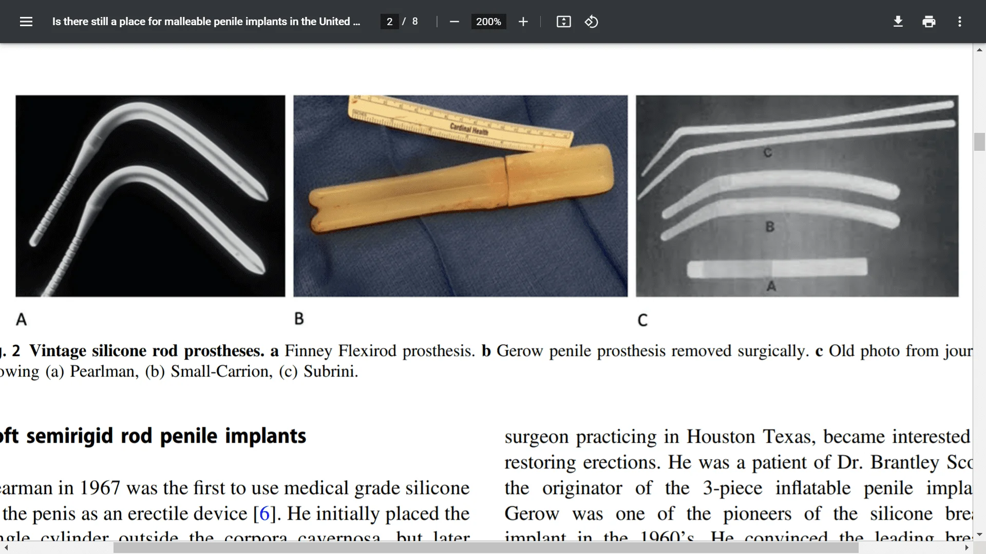 Is there still a place for malleable penile implants in the United ...