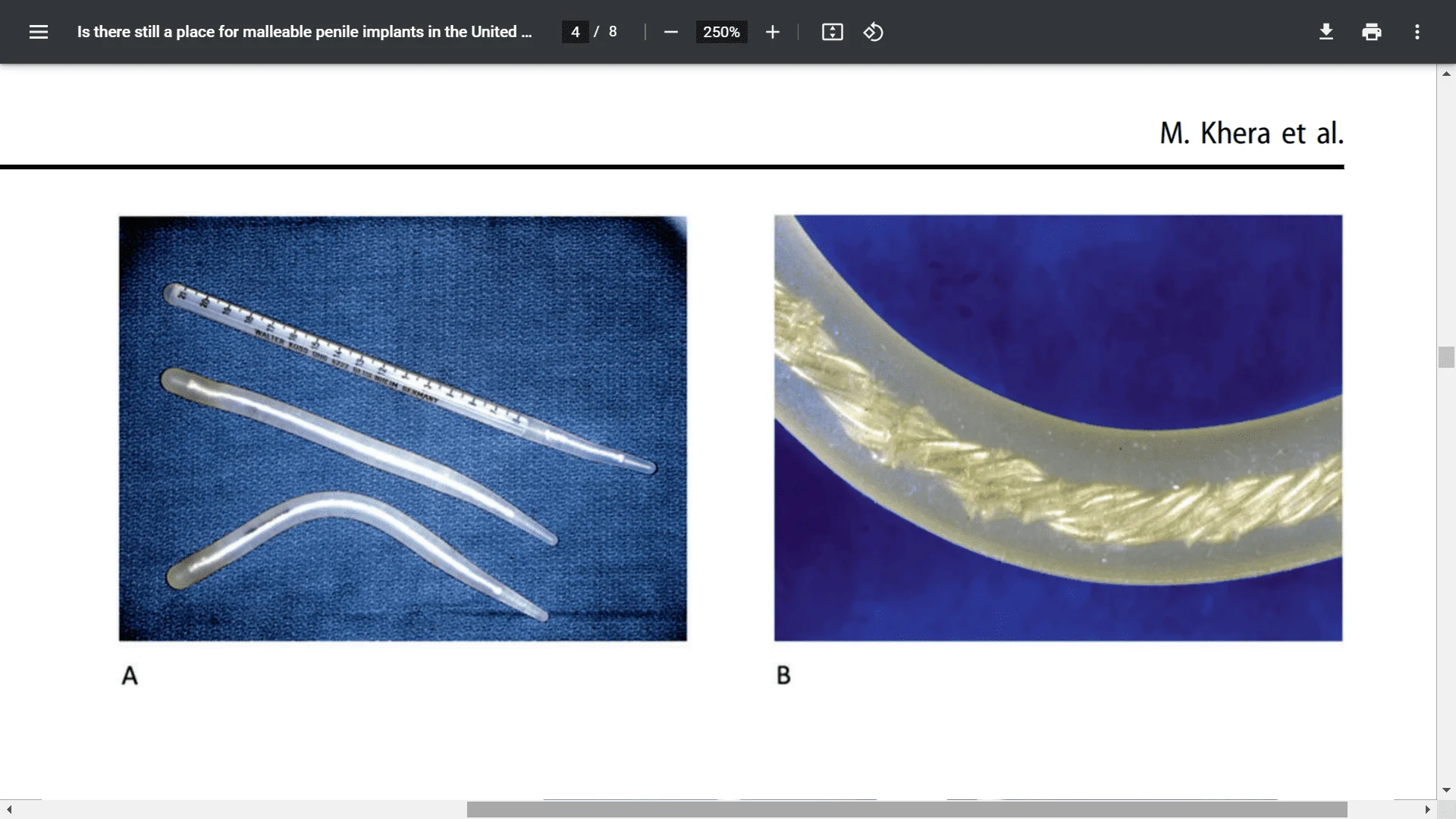 Is there still a place for malleable penile implants in the United ...