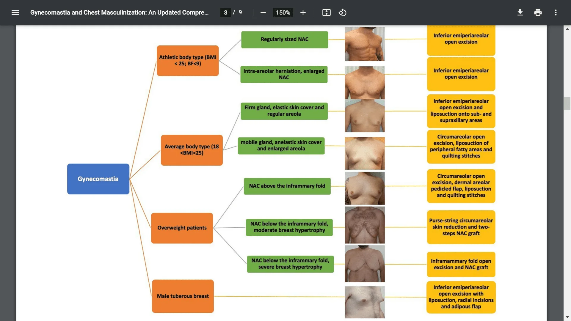 Gynecomastia and Chest Masculinization | Excel Male TRT Forum