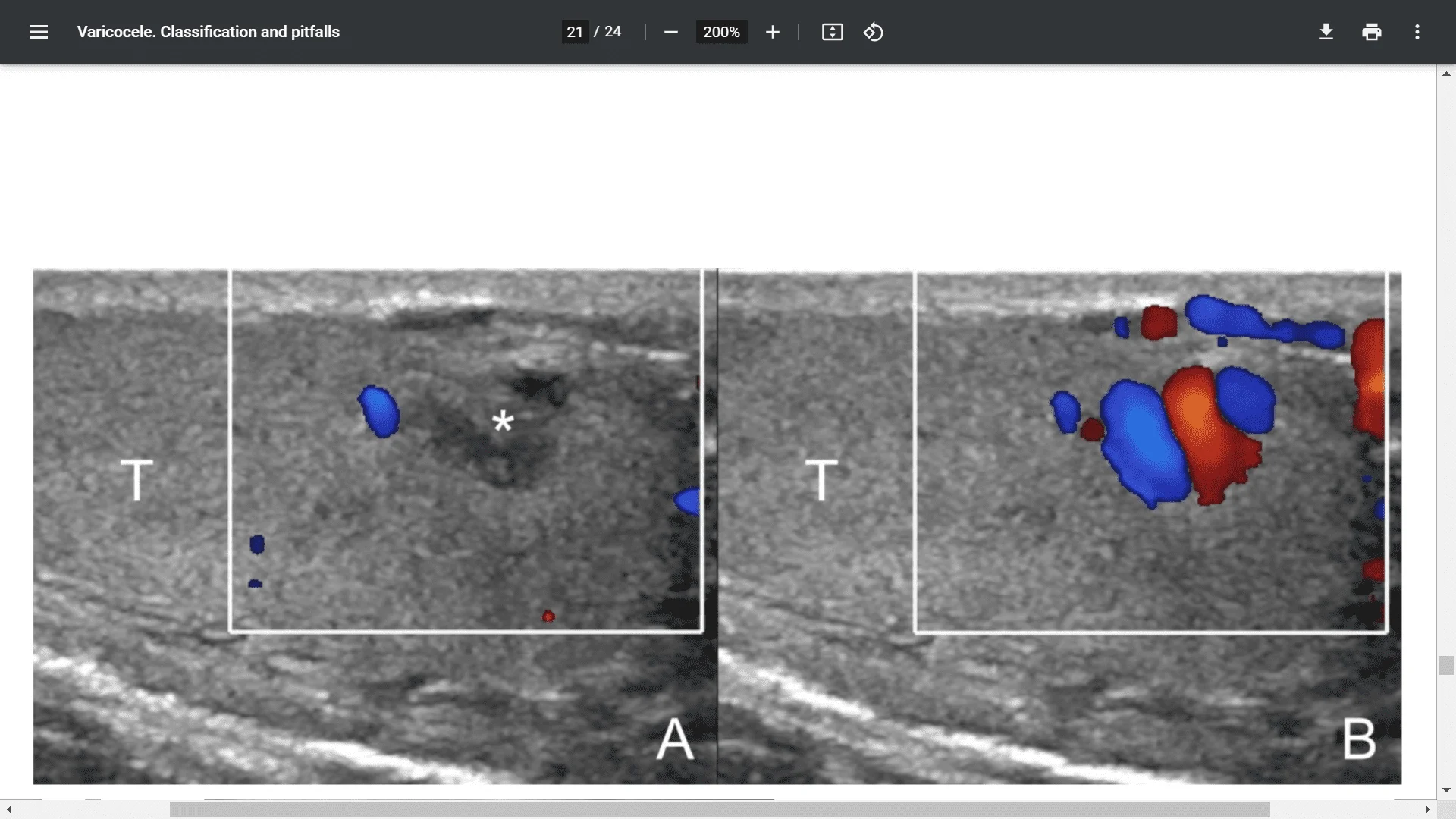 US imaging varicoceles | Excel Male TRT Forum