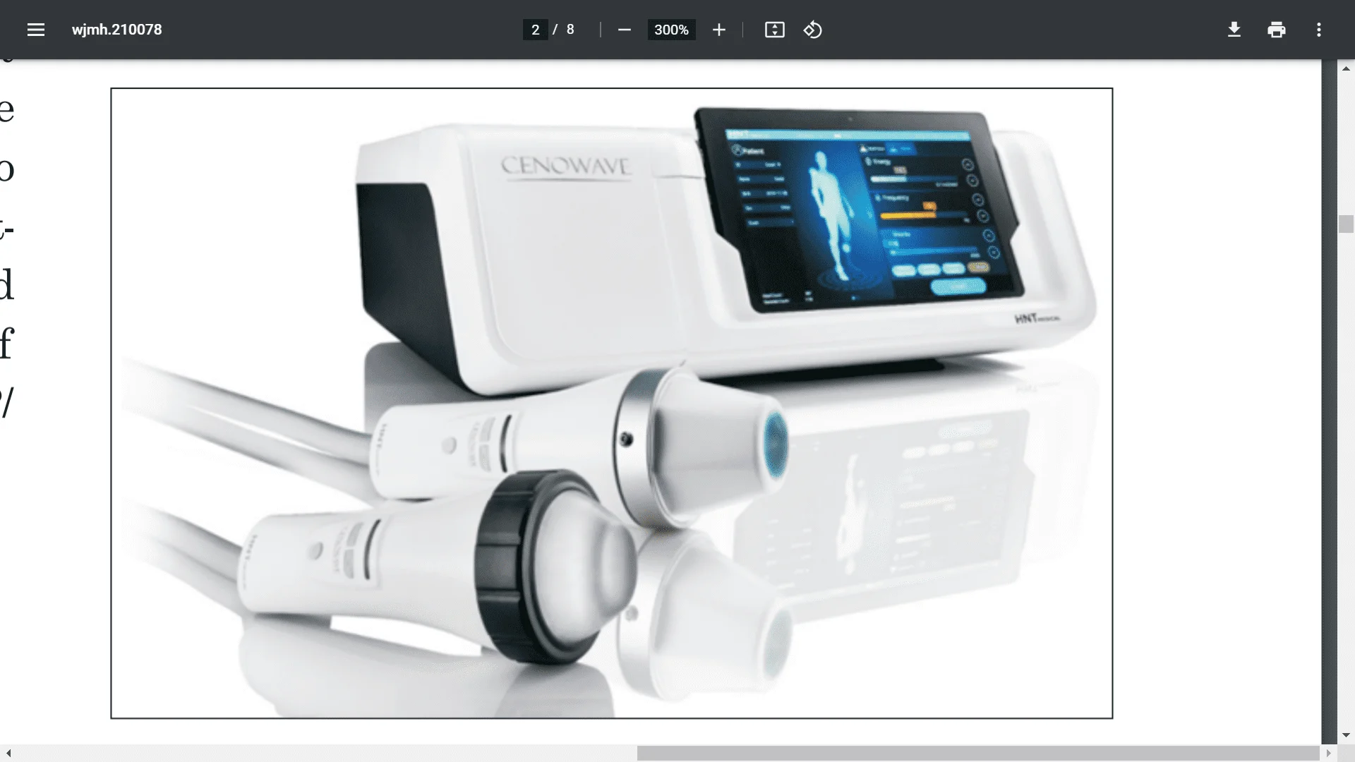 Clinical Efficacy of Shockwave Therapy in the Treatment of Chronic ...