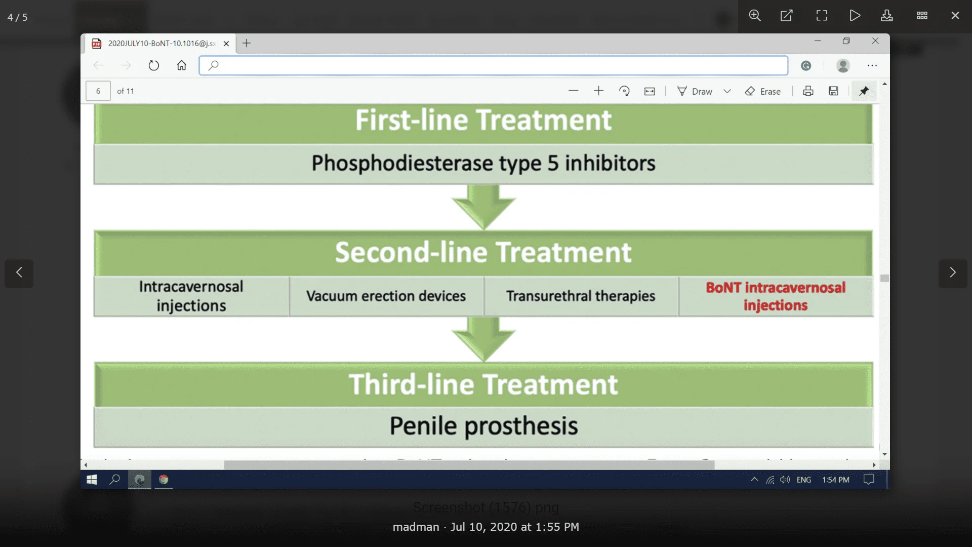Botox Penile Injections for Erectile Dysfunction | Excel Male TRT Forum