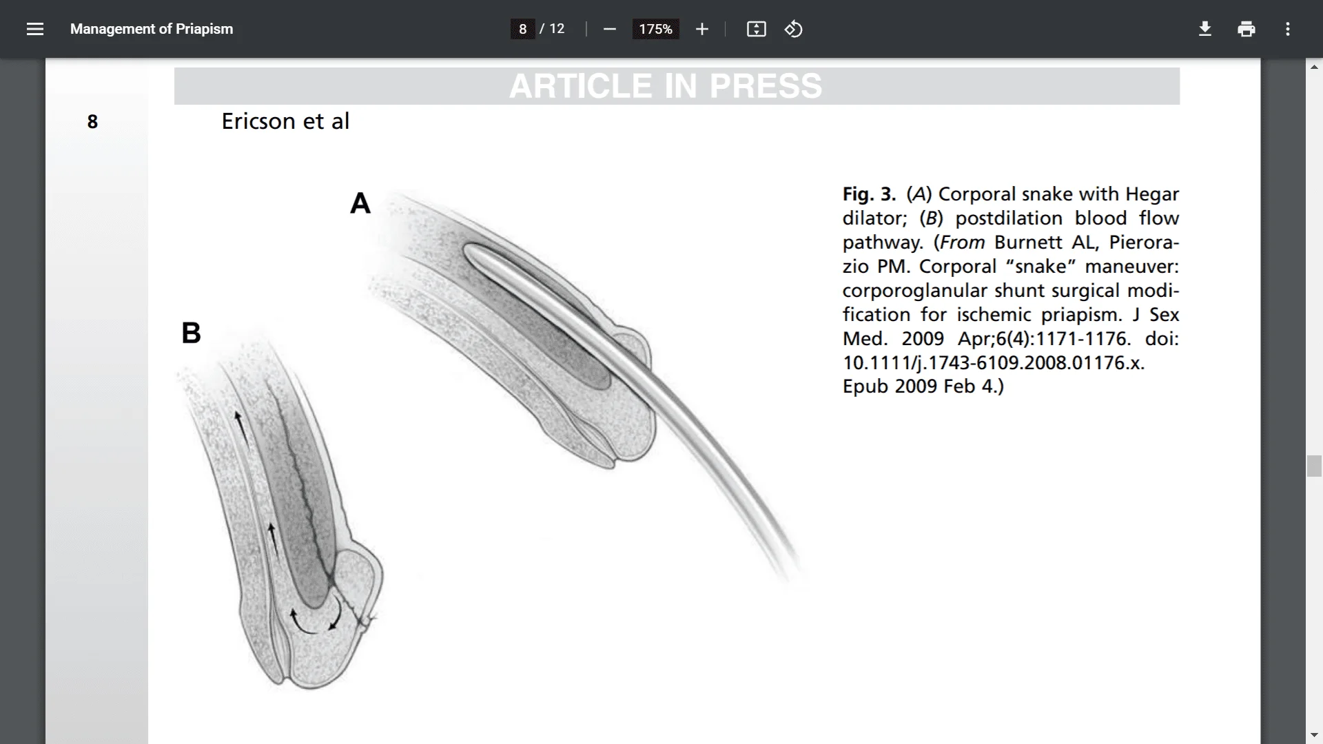 Management of Priapism | Excel Male TRT Forum