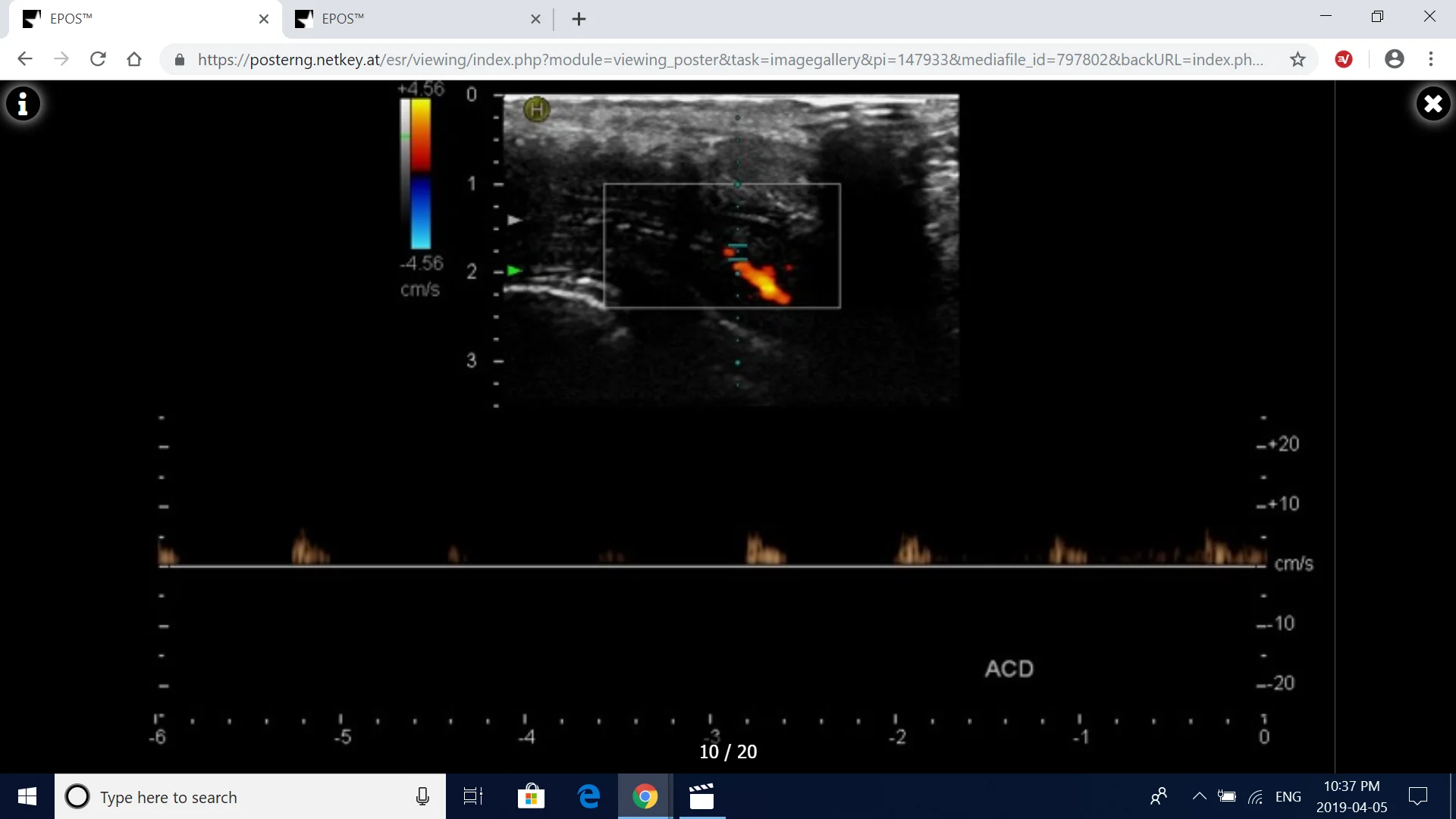 Radiologic Approach to Erectile Dysfunction. Main causes, diagnosis and ...