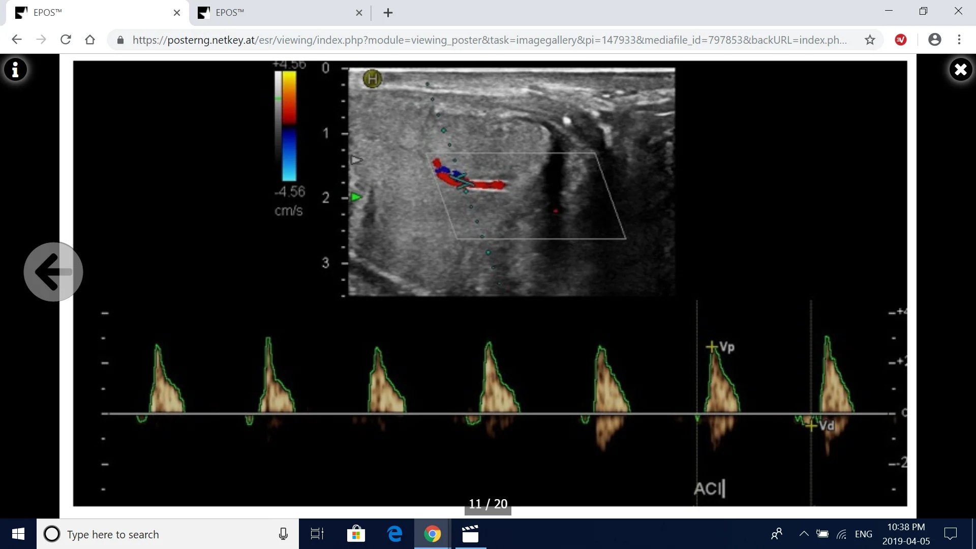 Radiologic Approach to Erectile Dysfunction. Main causes, diagnosis and ...