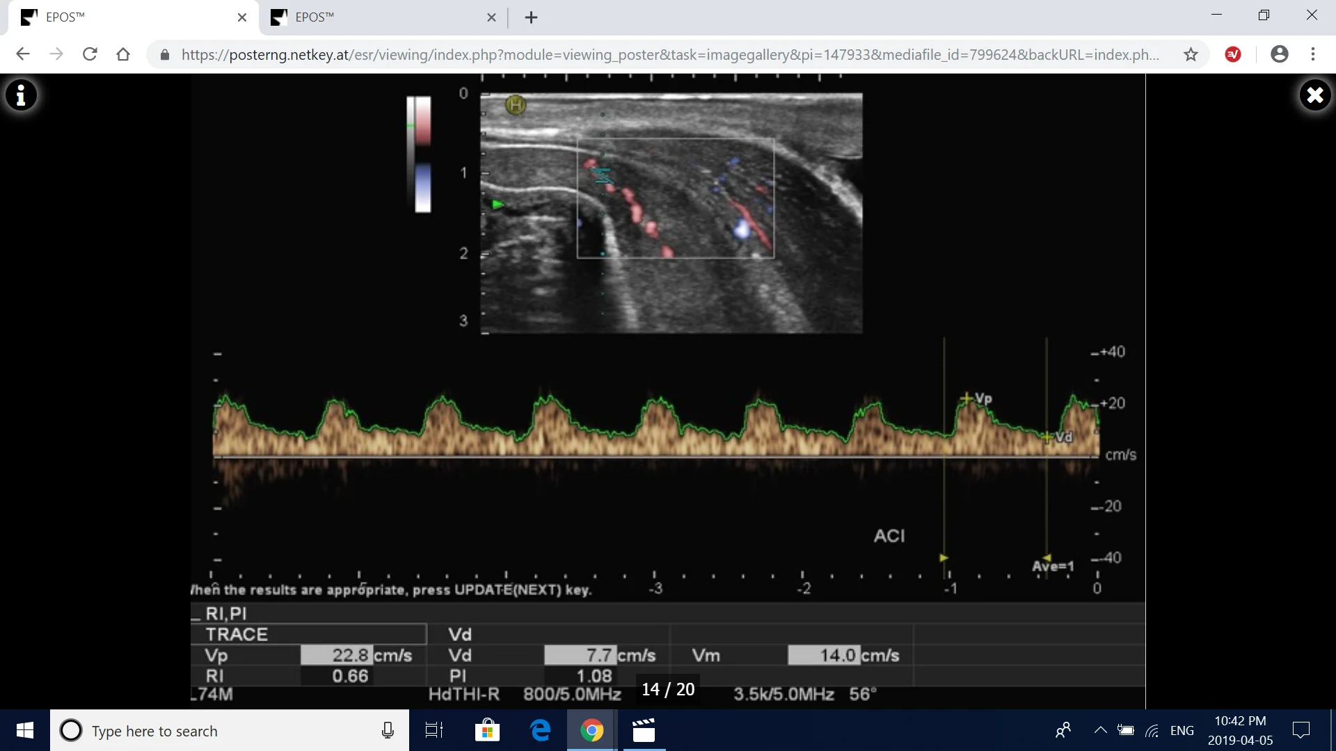 Radiologic Approach to Erectile Dysfunction. Main causes, diagnosis and ...