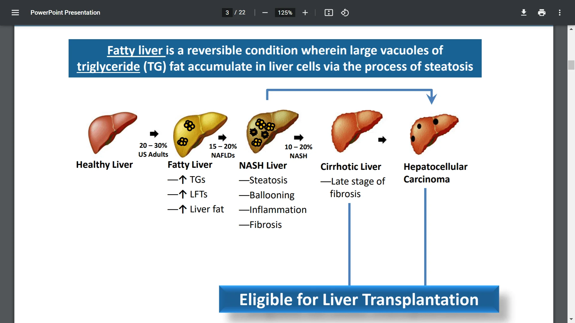 LPCN 1148 Oral T (Testosterone Tridecanoate) for Liver Cirrhosis ...