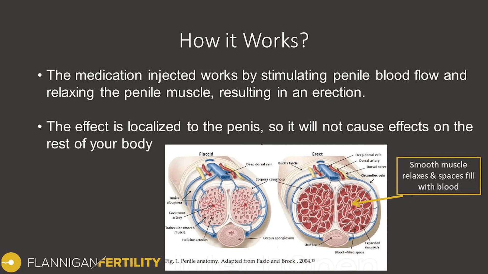Penile Injection Therapy: Overview and how to perform injections ...