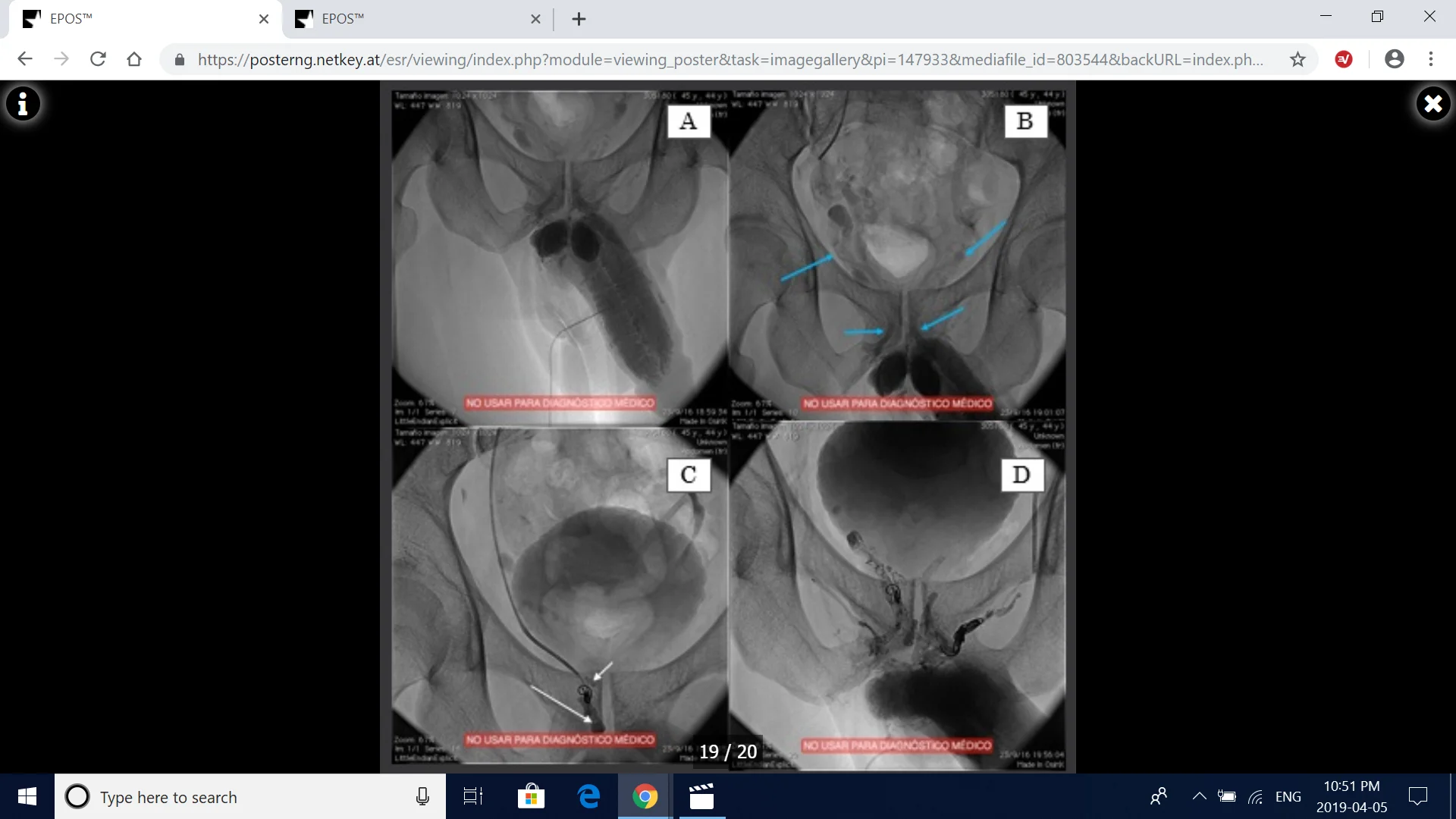 Radiologic Approach To Erectile Dysfunction Main Causes Diagnosis And