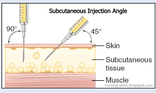Best injection technique for low dose daily subcutaneous testosterone ...