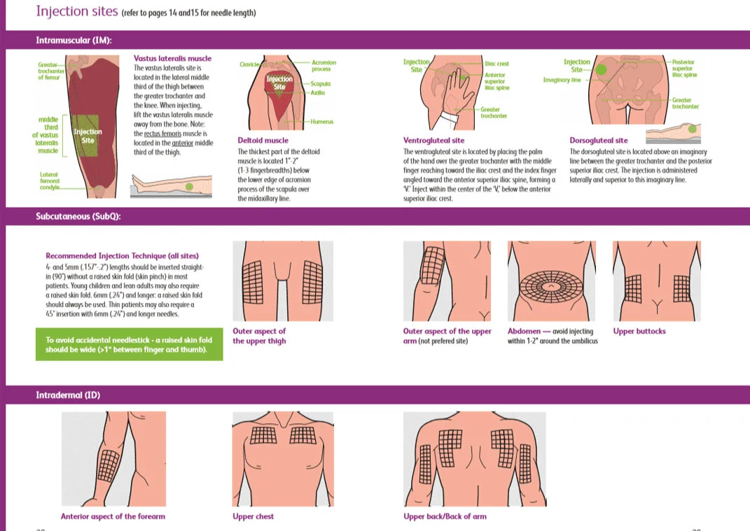 How to Inject Testosterone Intramuscularly, Shallow IM or ...